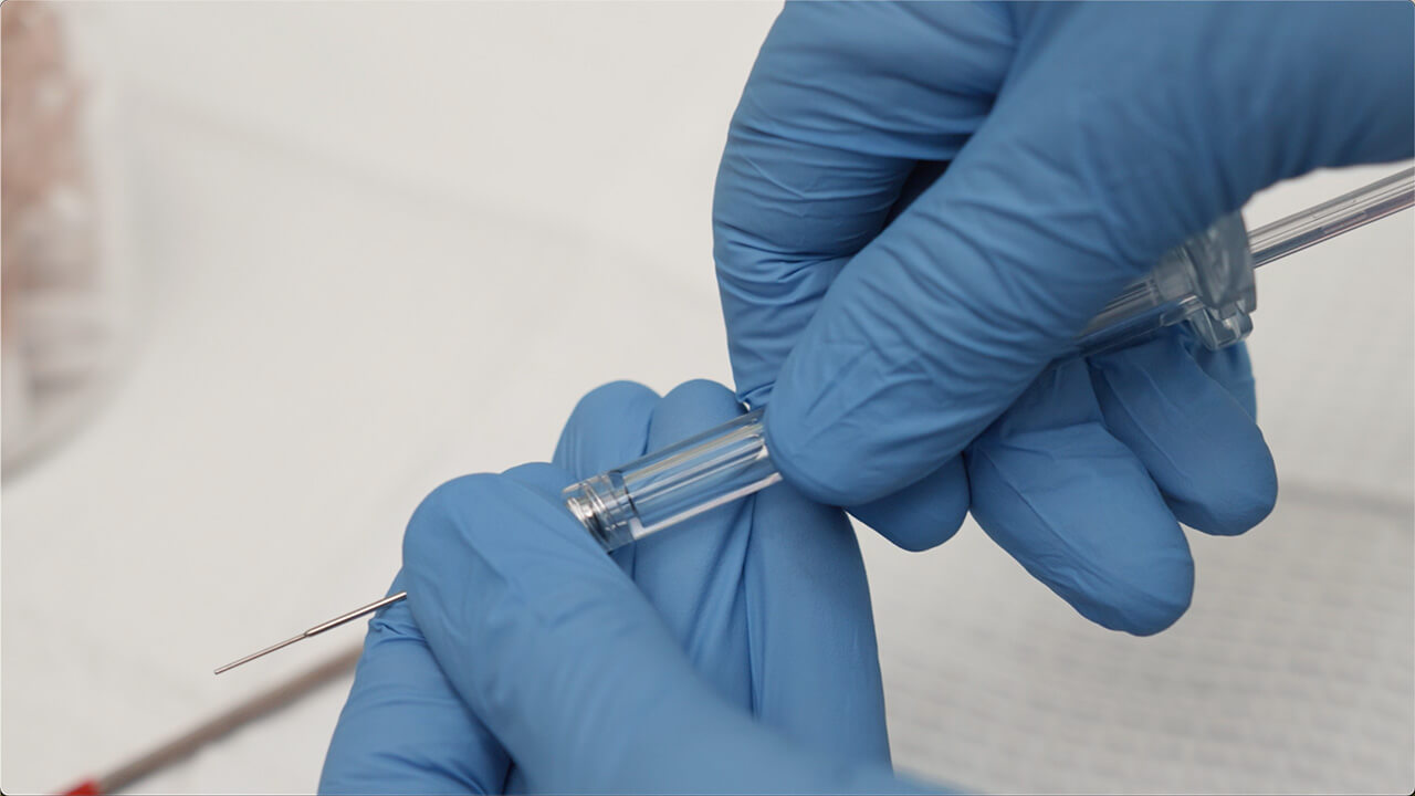 Administration of LACRIFILL® - Lacrifill®